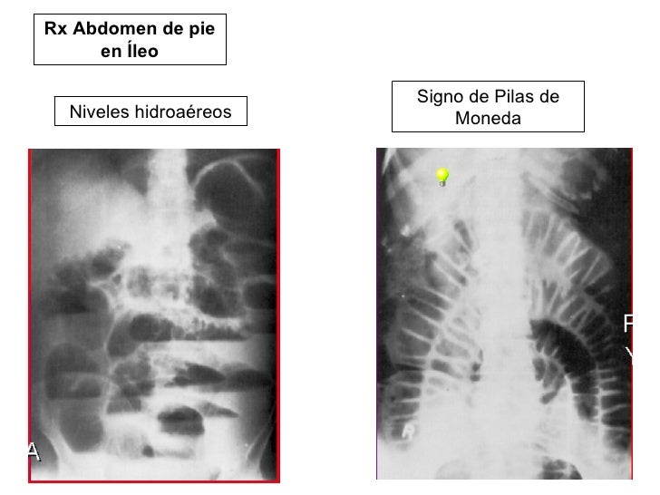 Dolor abdominal - Medicina Interna II Uai