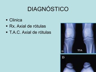 DOLOR ANTERIOR DE RODILLA.ppt