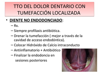 Dolor dentario | PPT