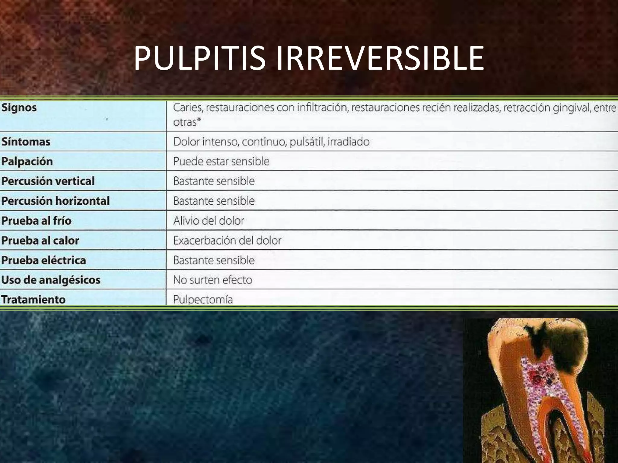 dolor de origen pulpar y periodontal.(4).pptx