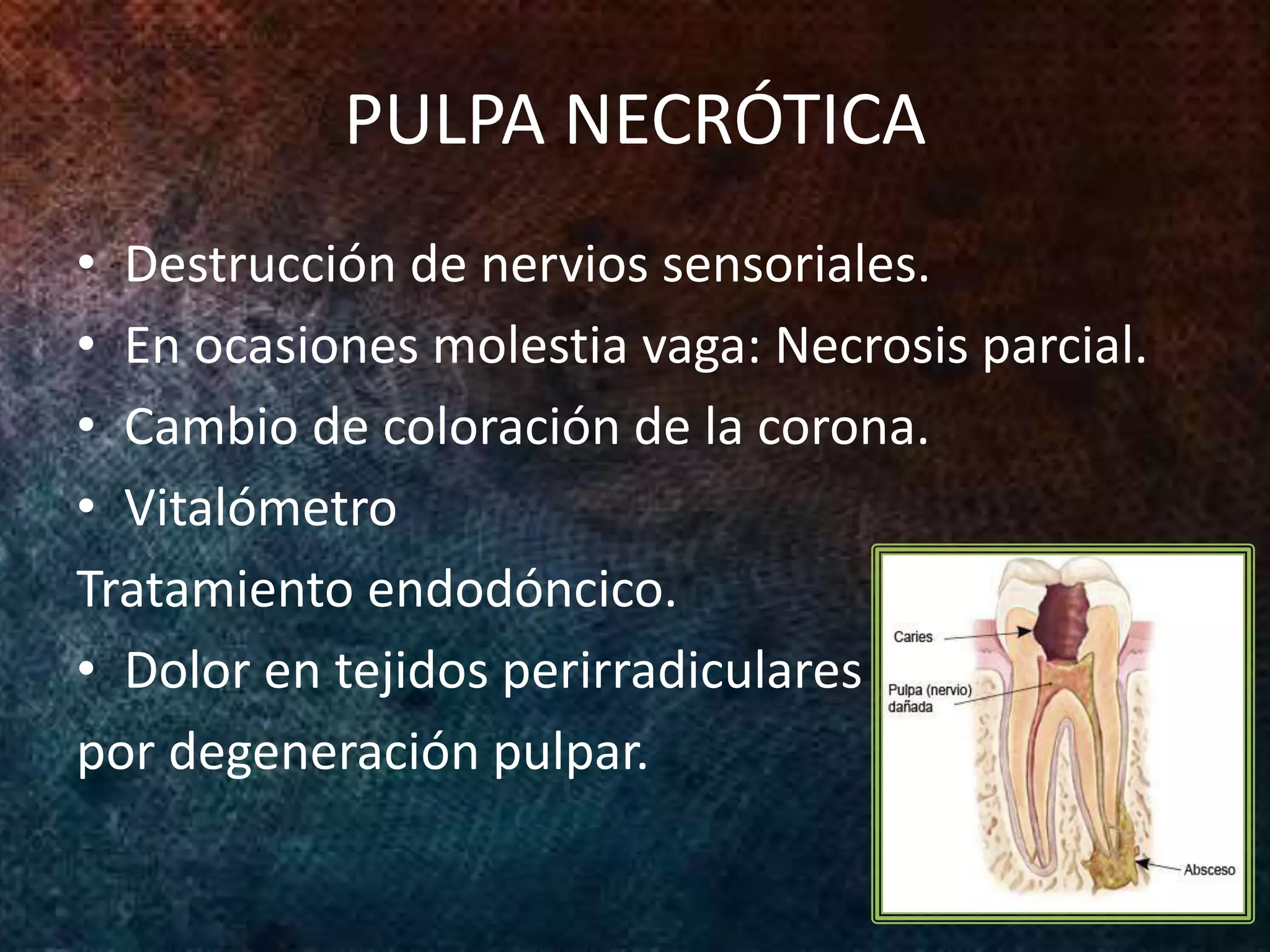 dolor de origen pulpar y periodontal.(4).pptx