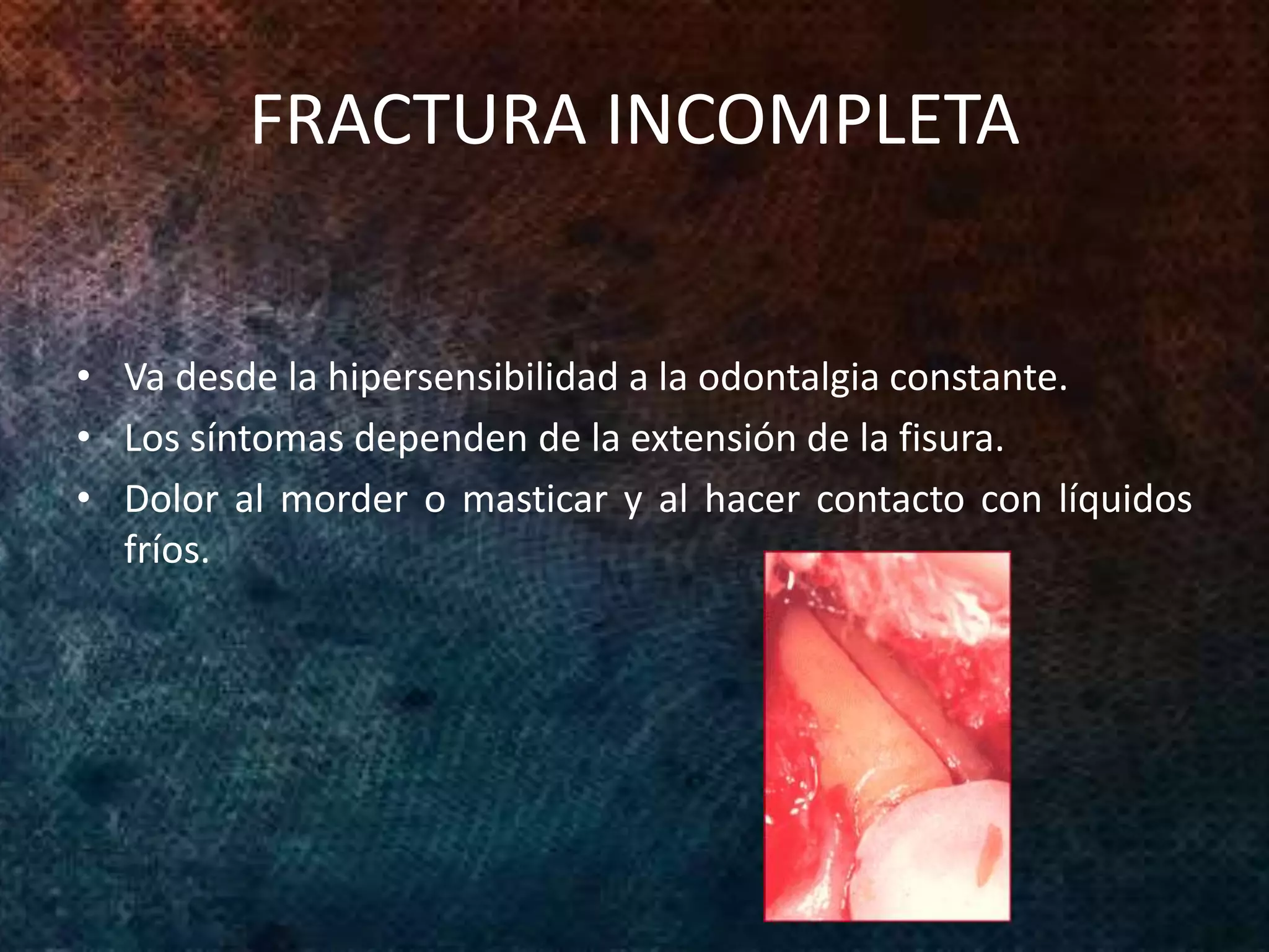 dolor de origen pulpar y periodontal.(4).pptx