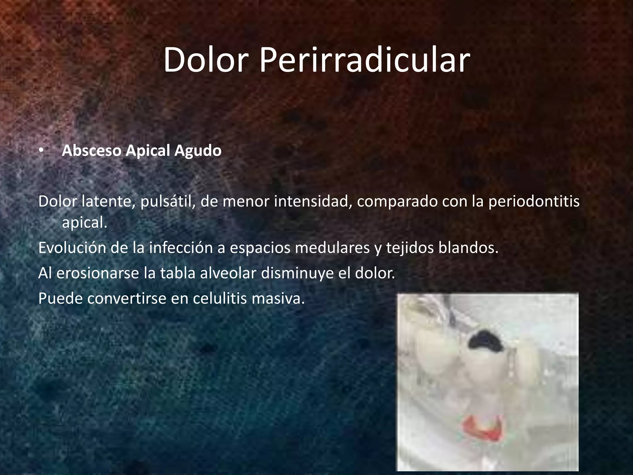 dolor de origen pulpar y periodontal.(4).pptx