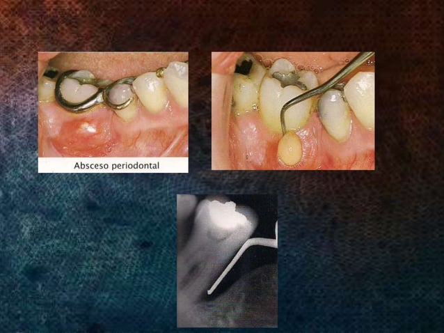 dolor de origen pulpar y periodontal.(4).pptx