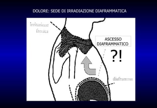 Dolore Addome Acuto | PPT
