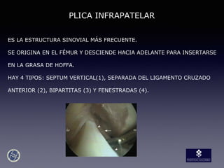 DOLOR EN LA CARA ANTERIOR DE LA RODILLA | PPTX