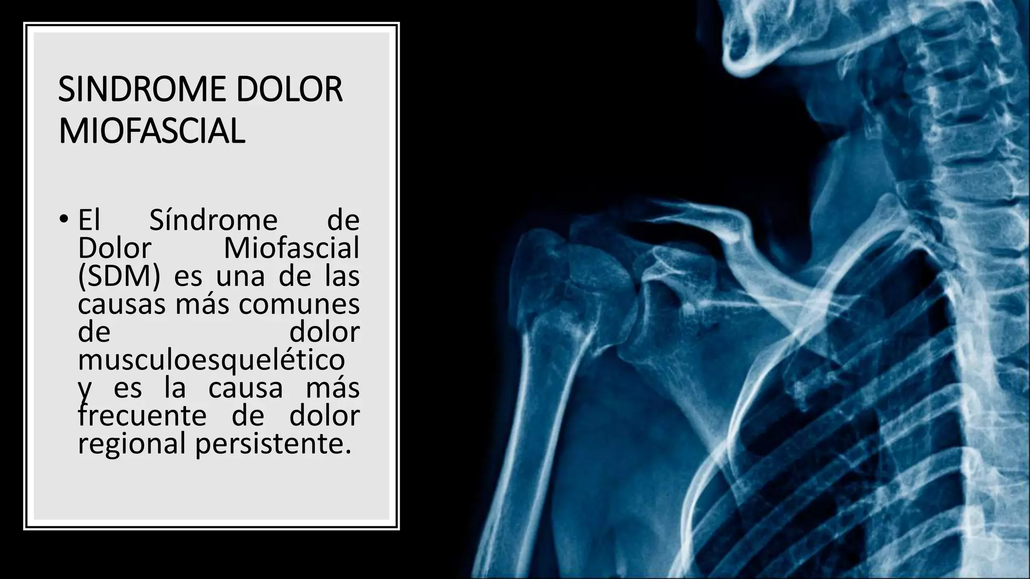 DOLOR MUSCULOESQUELETICO.pptx