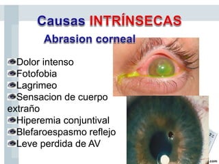 Dolor ocular | PPTX