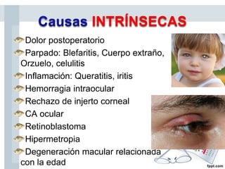 Dolor ocular | PPTX