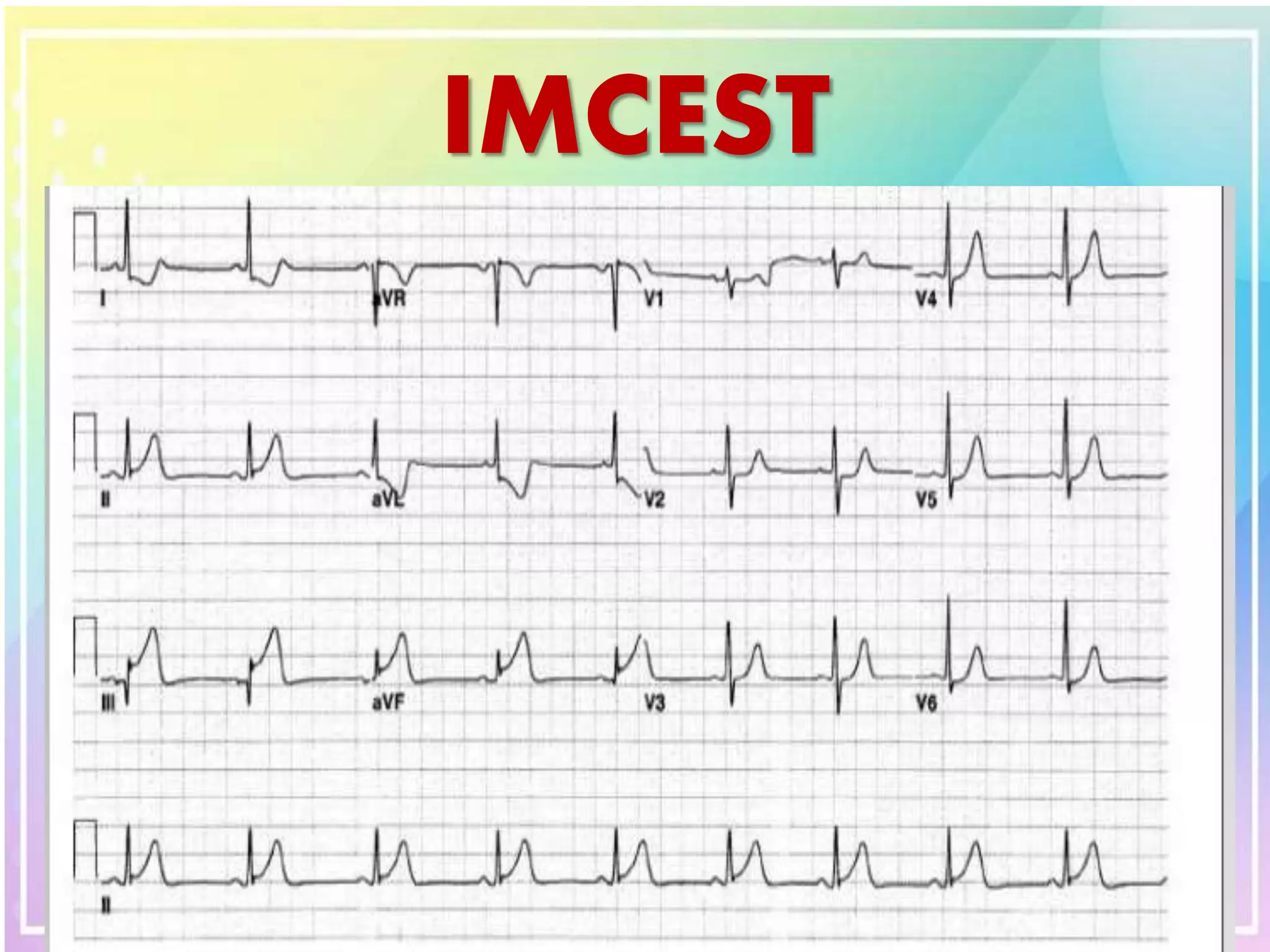 Dolor precordial y toracico | PPTX | Medical Health