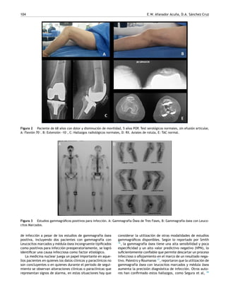 Dolor protésico de rodilla en pacientes con baja probabilidad de ...
