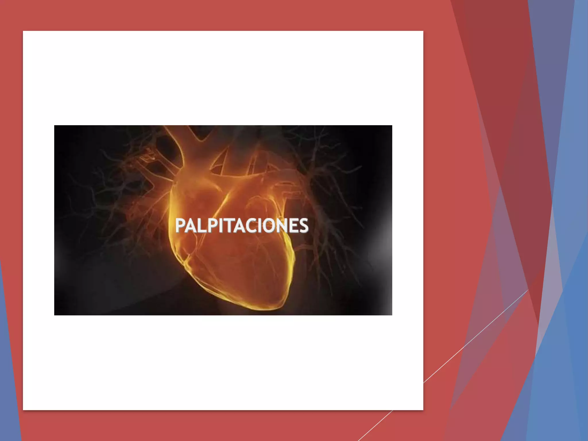 DOLOR RETROESTERNAL Y PALPITACION.pptx