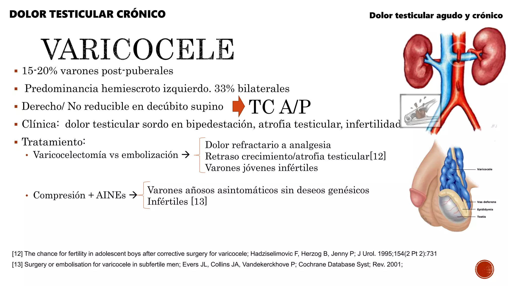 Dolor testicular agudo y crónico (Testicular Pain. Acute and Chronic ...