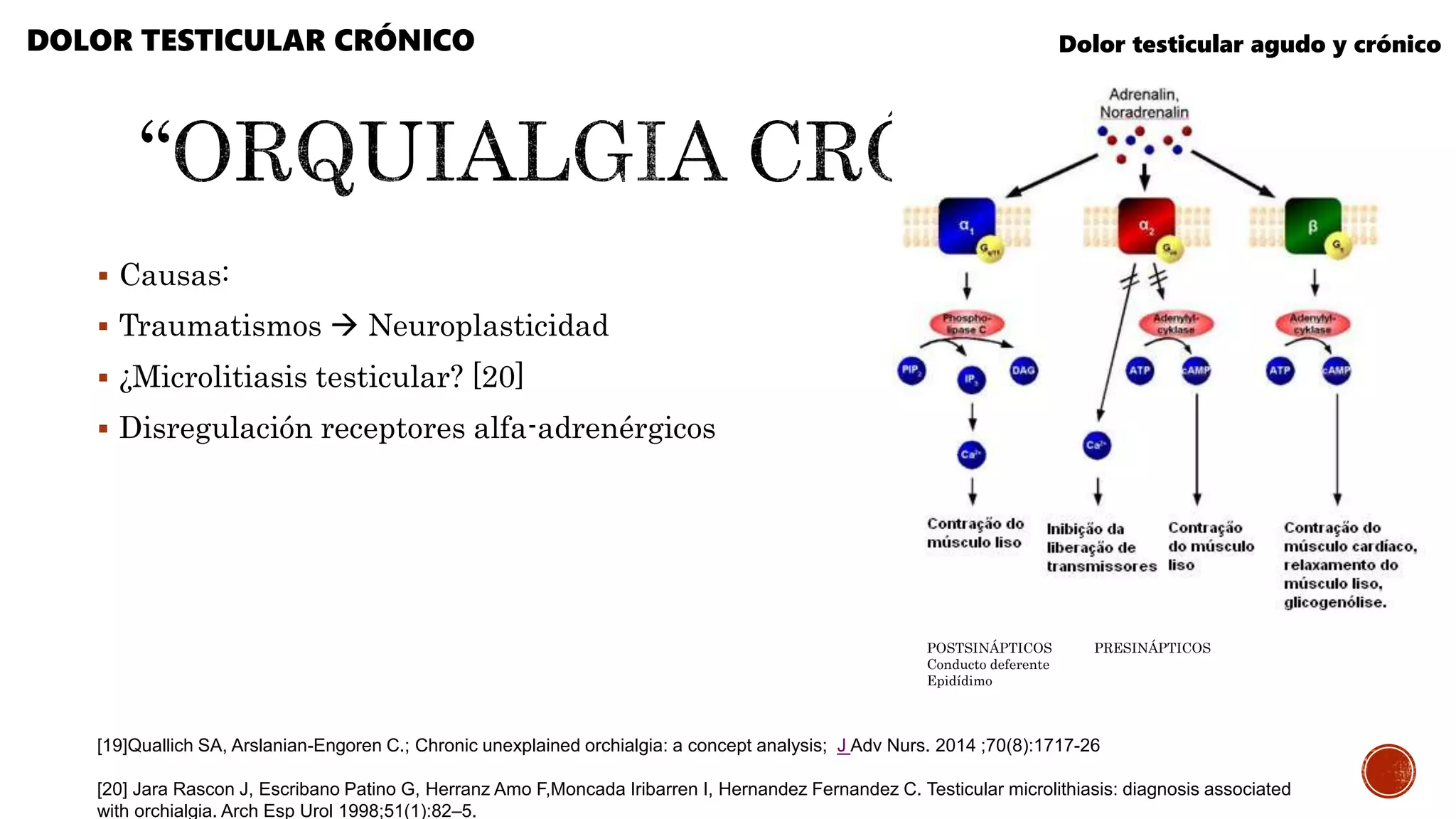 Dolor testicular agudo y crónico (Testicular Pain. Acute and Chronic ...