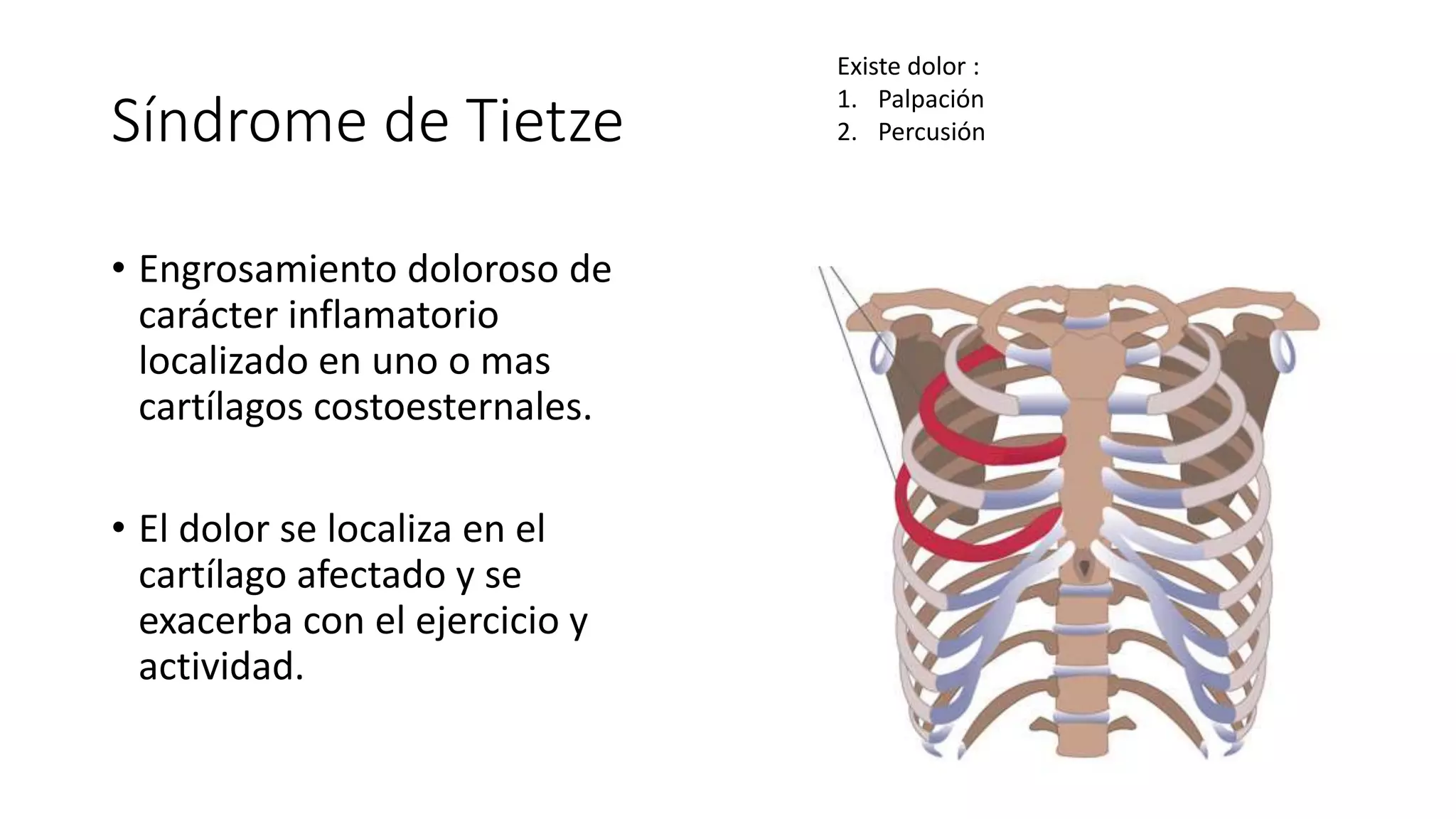 Dolor toracico : Angina , embolia pulmonar , reflujo gastroesofagico | PPT