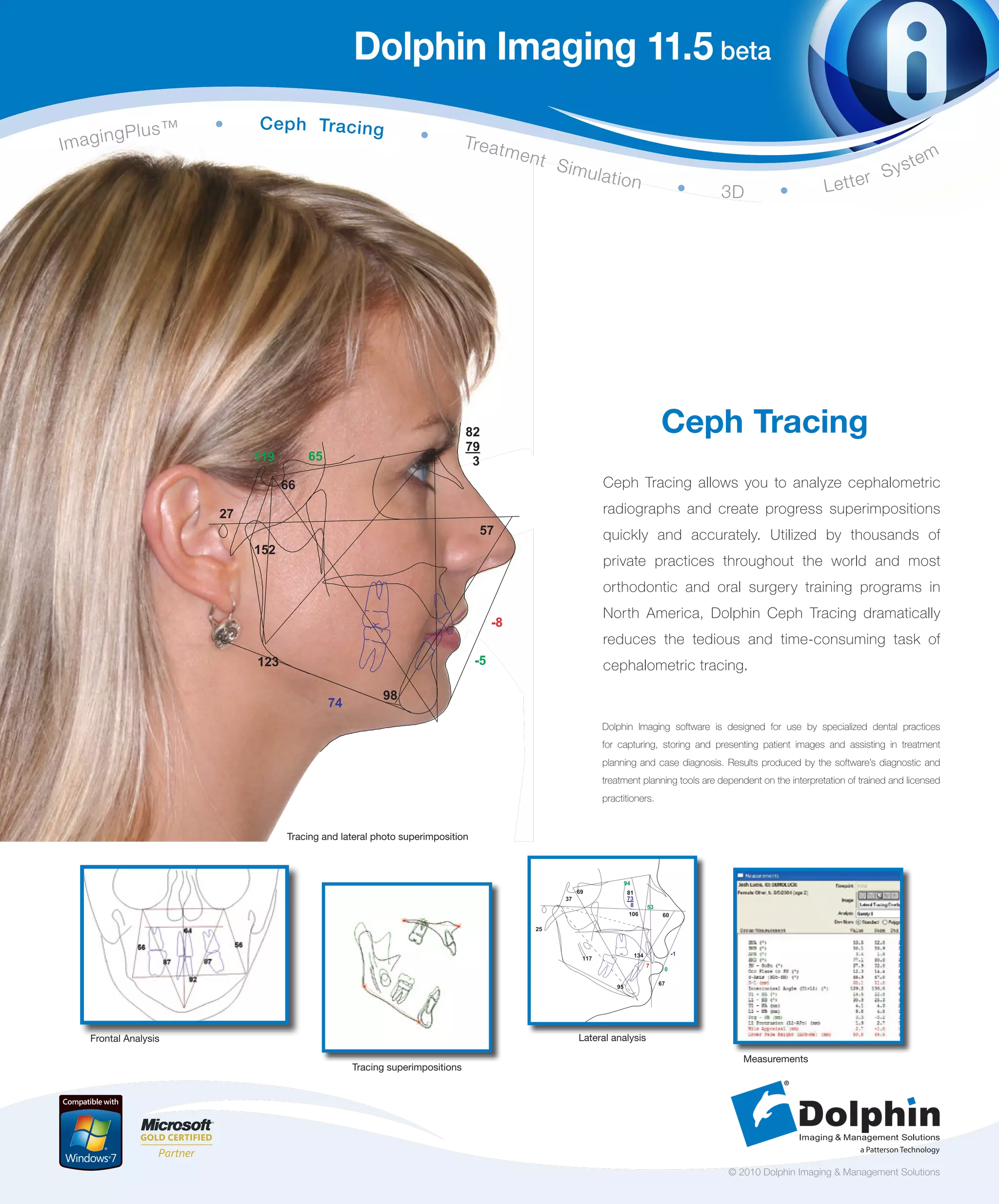 Dolphin Ceph Tracing Tool | PDF