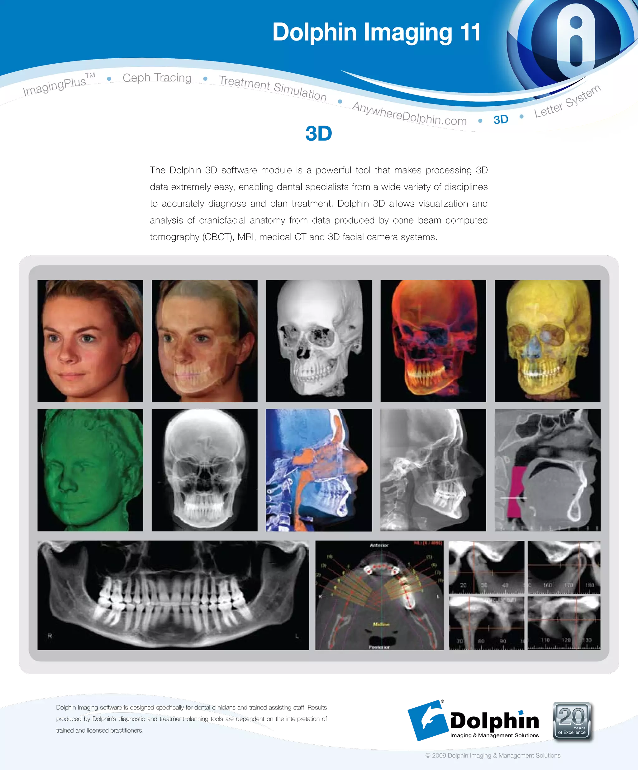 Dolphin Imaging | PDF | 3-D Graphics | Computer Software and Applications