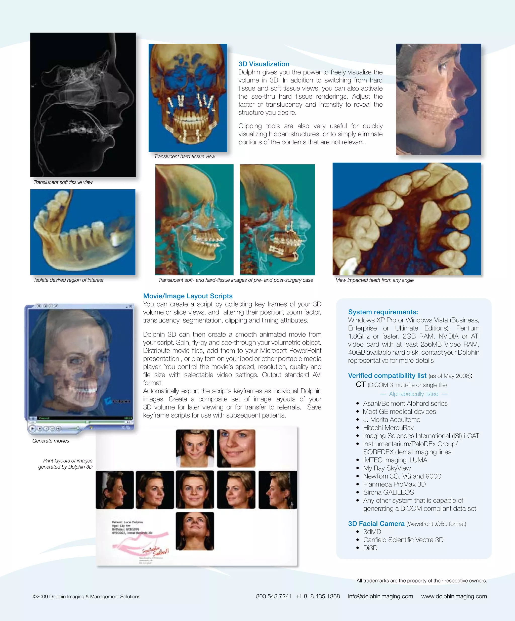 Dolphin Imaging | PDF