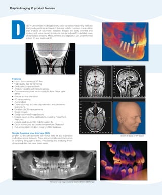 Dolphin Imaging | PDF | 3-D Graphics | Computer Software and Applications