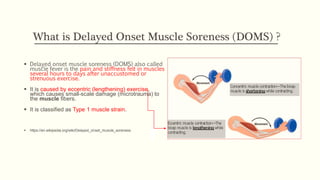 Delayed Onset Muscle Soreness Diagram