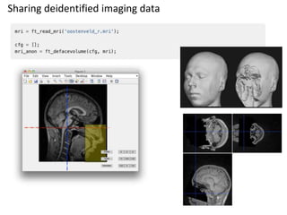 Donders neuroimage toolkit - open science and good practices | PPT