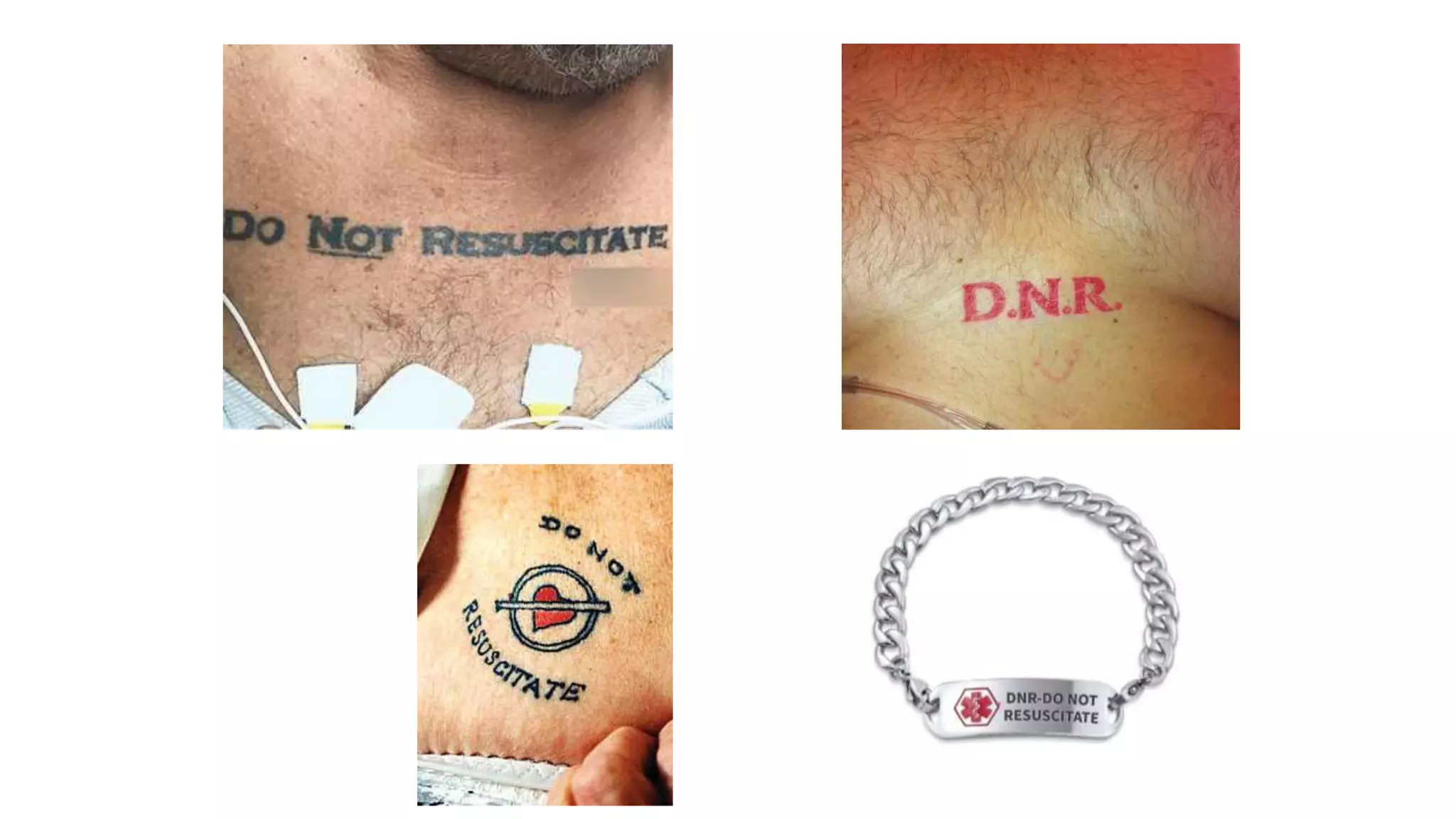 Do Not Resuscitate (DNR) Orders | PPTX | First Aid | Injuries