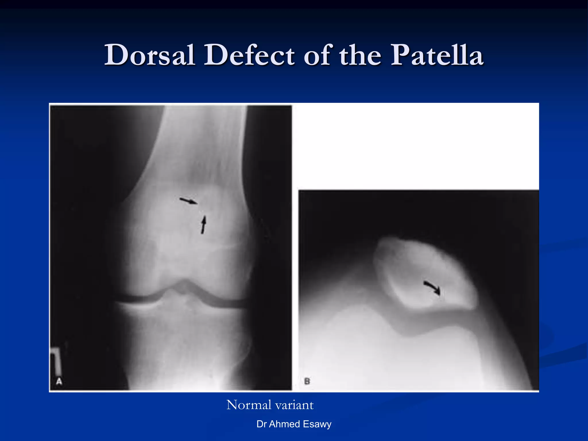 “Don’t touch” lesions new version Dr Ahmed Esawy | PDF
