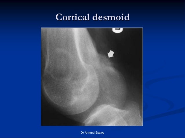 “Don’t touch” lesions new version Dr Ahmed Esawy