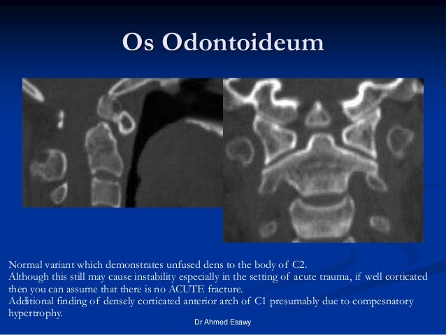 “Don’t touch” lesions new version Dr Ahmed Esawy