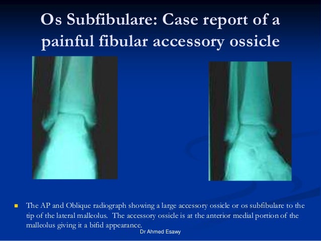 “Don’t touch” lesions new version Dr Ahmed Esawy
