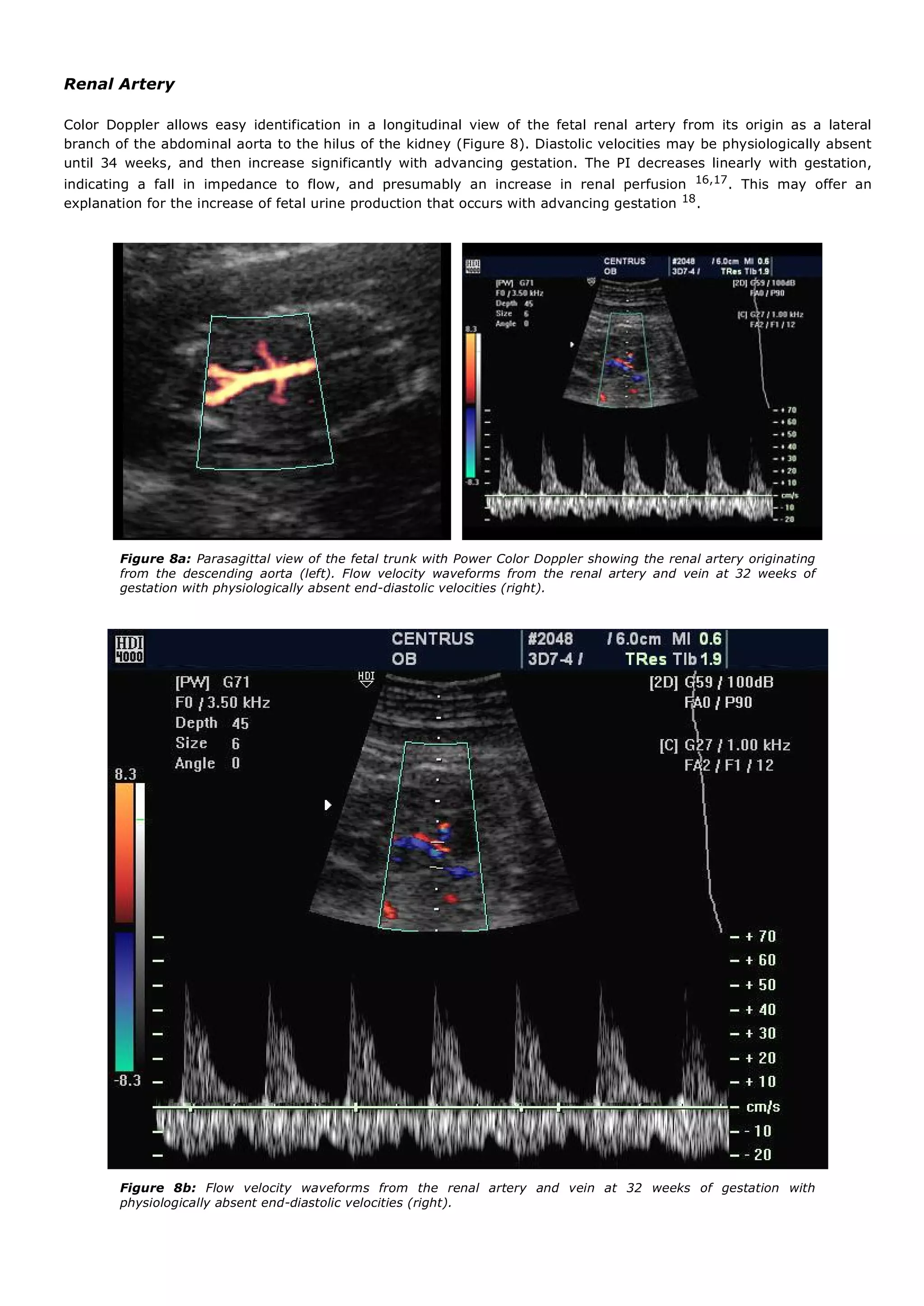 Doppler in-obstetrics | PDF