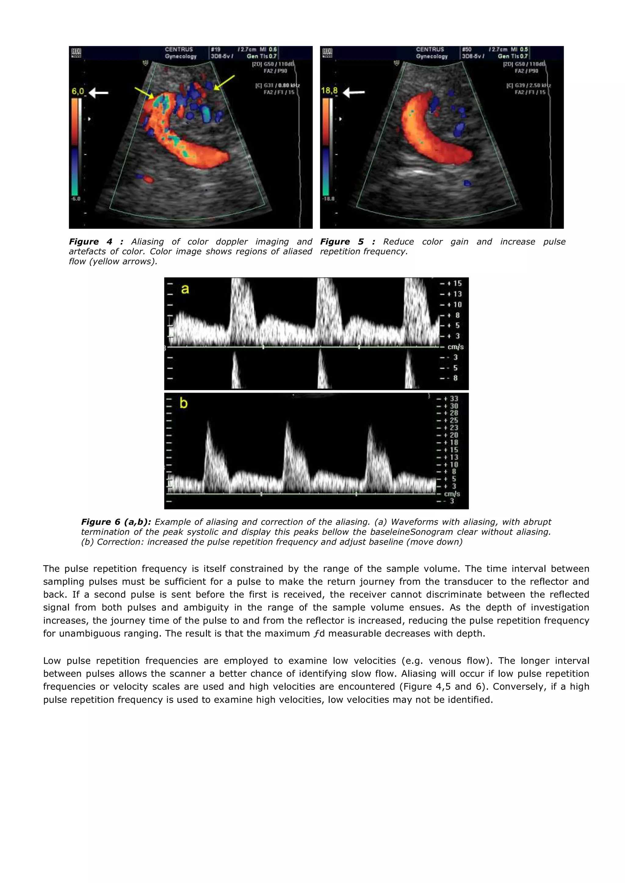 Doppler in-obstetrics | PDF