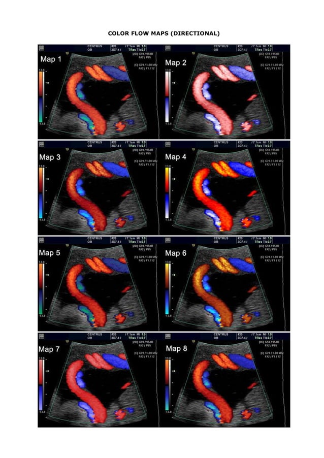 Doppler in-obstetrics | PDF