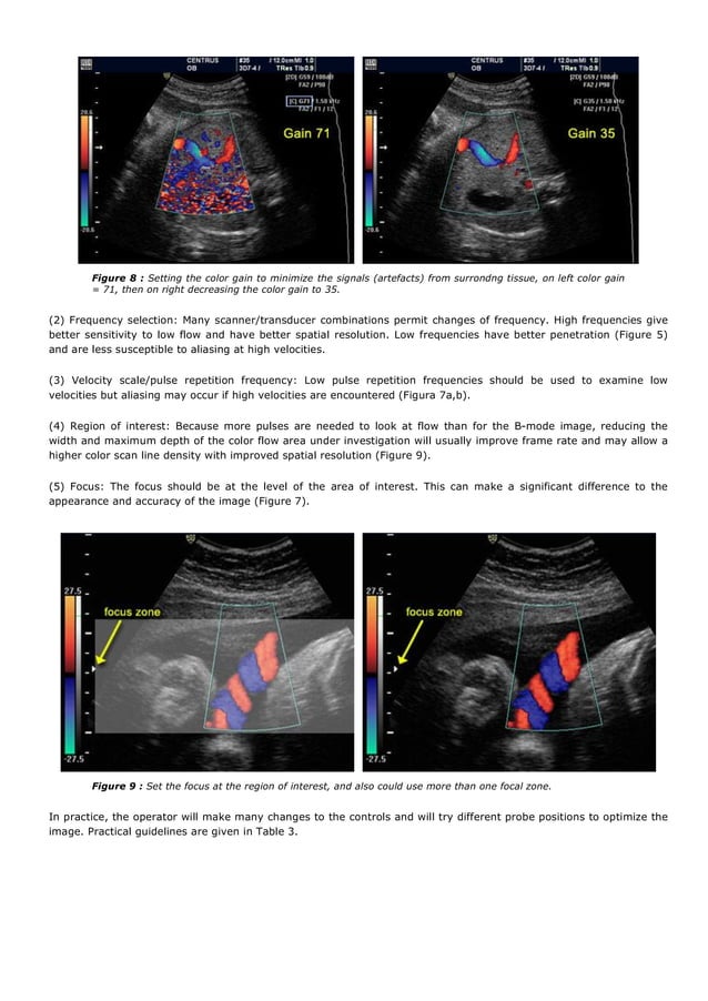 Doppler in-obstetrics | PDF