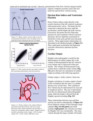 Doppler assessment of Aortic valve | PDF