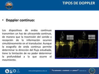 Doppler medios diagnostico y cuidados de enfermeria | PPTX