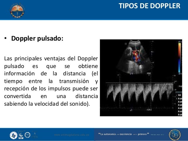 Doppler medios diagnostico y cuidados de enfermeria