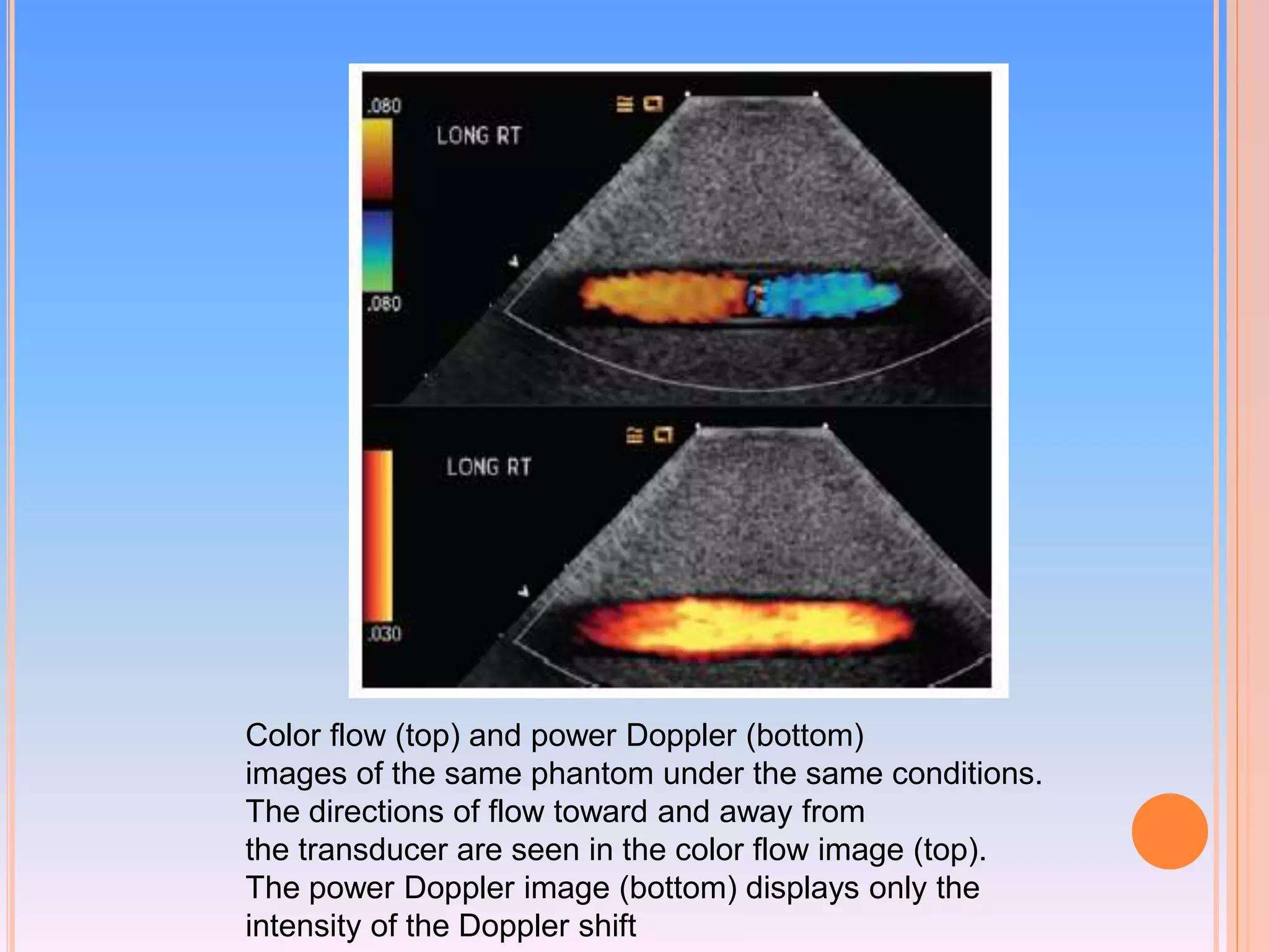 Doppler Ultrasonography And Advancements in USG | PPTX
