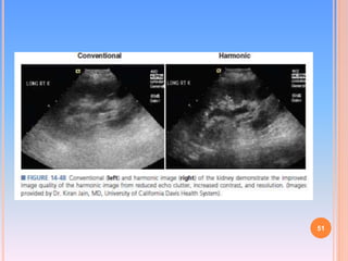 Doppler Ultrasonography And Advancements in USG | PPTX