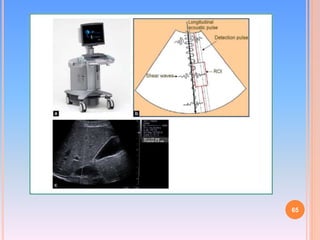 Doppler Ultrasonography And Advancements in USG | PPTX