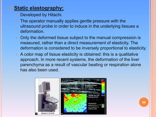 Doppler Ultrasonography And Advancements in USG | PPTX
