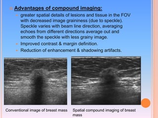 Doppler Ultrasonography And Advancements in USG | PPTX