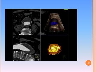 Doppler Ultrasonography And Advancements in USG | PPTX