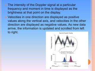 Doppler Ultrasonography And Advancements in USG | PPT
