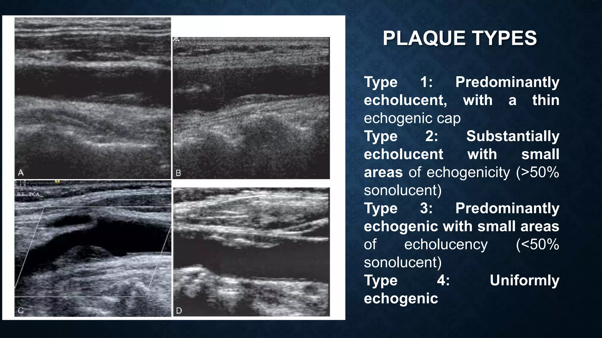Doppler applications copy.pptx