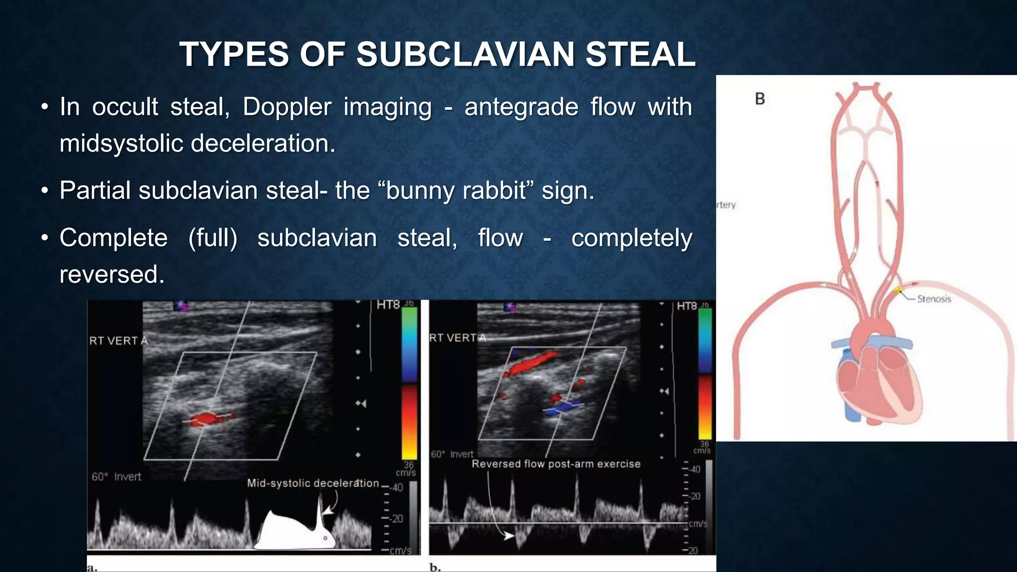 Doppler applications copy.pptx
