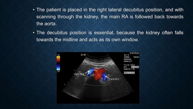 Doppler applications copy.pptx | Heart and Cardiovascular Diseases ...