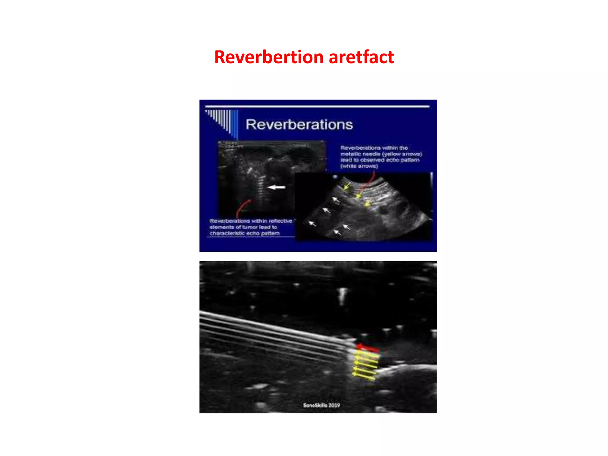 Doppler artefact (1) | PPTX