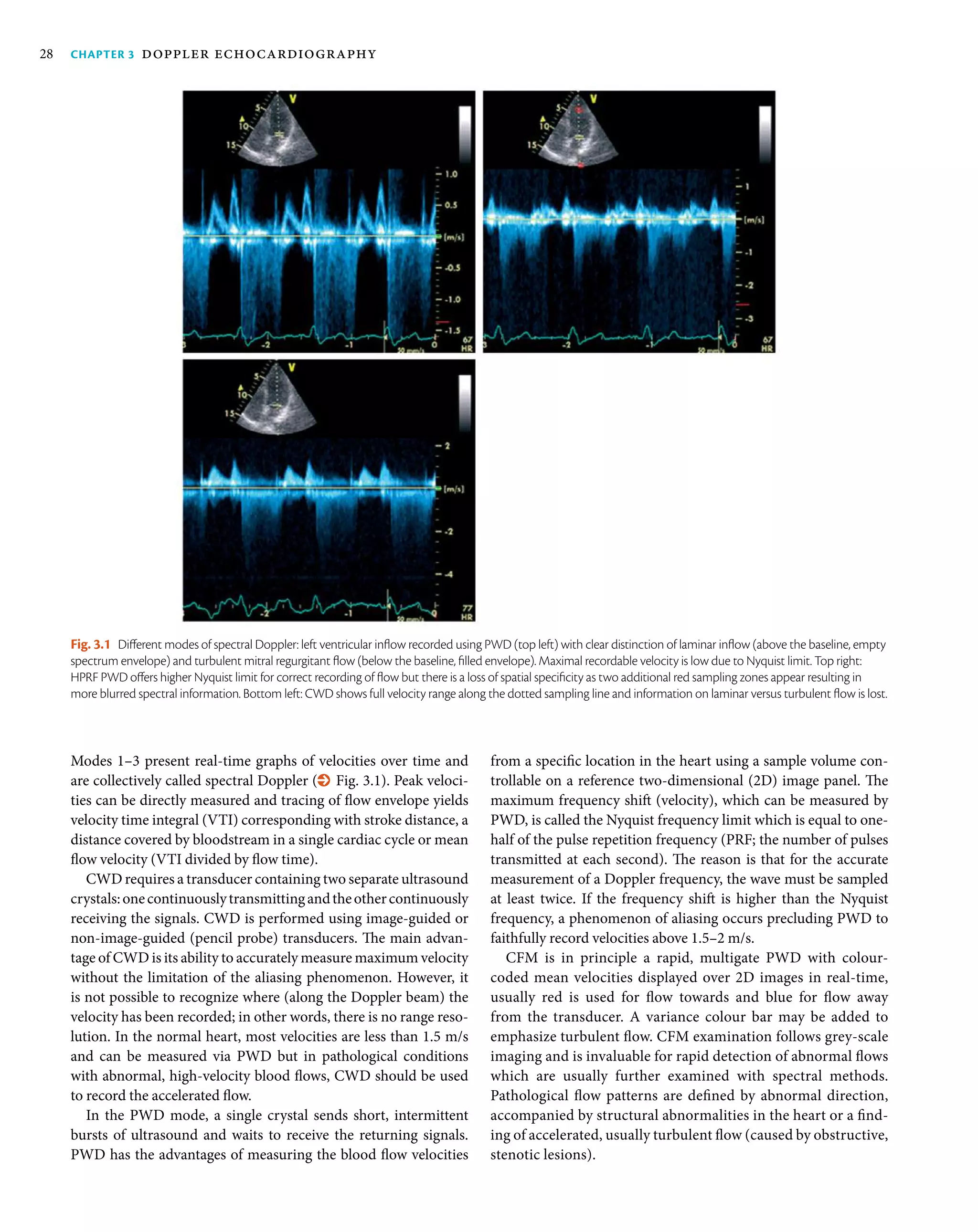 Doppler echocardiography | PDF | Heart and Cardiovascular Diseases | Diseases and Conditions