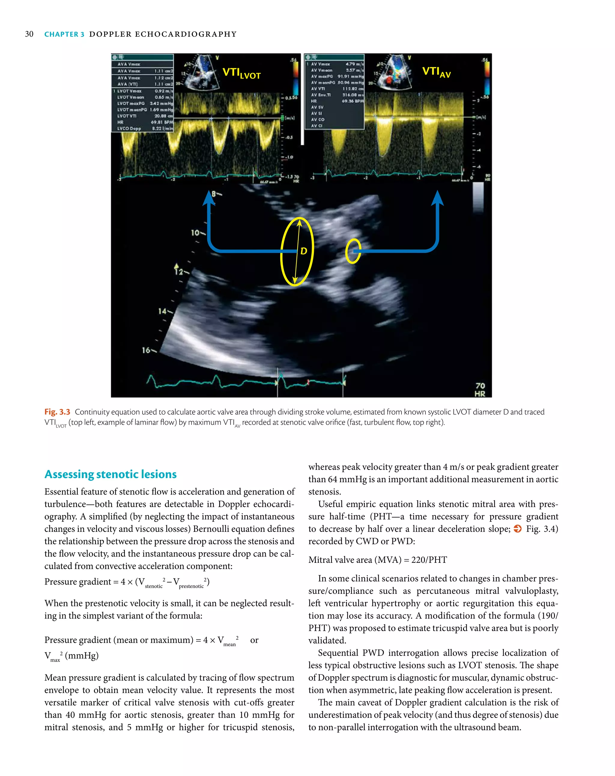 Doppler echocardiography | PDF | Heart and Cardiovascular Diseases | Diseases and Conditions